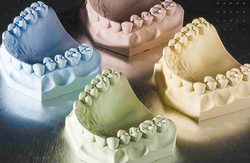 Achieve Precision and Quality with Alvy's Gypsum Options – Alvy Dental