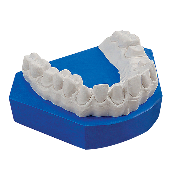 WHIP MIX FLOWSTONE FS 33#/15KG – Alvy Dental