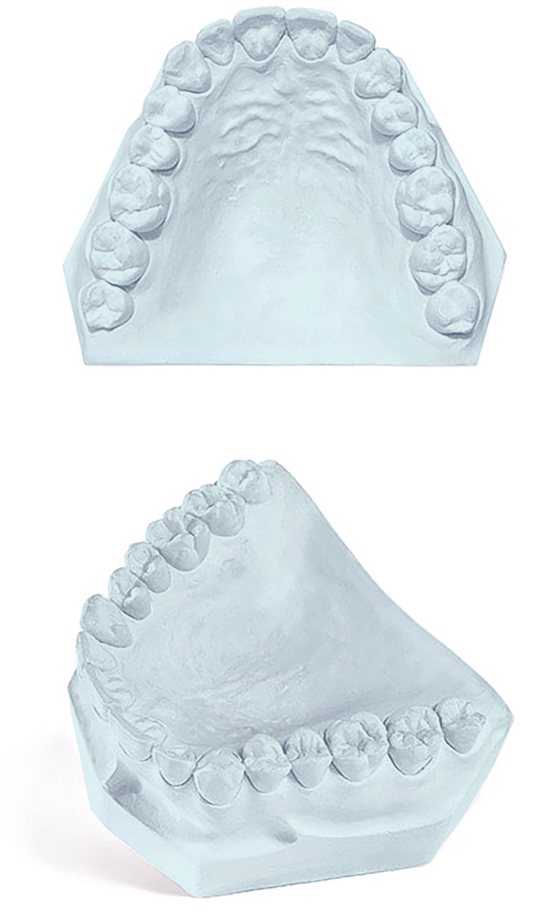 Garreco Tecstone White 44.75 lbs #1013050 – Alvy Dental