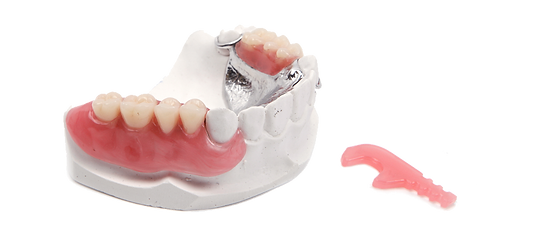 AcryFlex Pre Made Clasp PINK/ CLEAR pk/10 – Alvy Dental